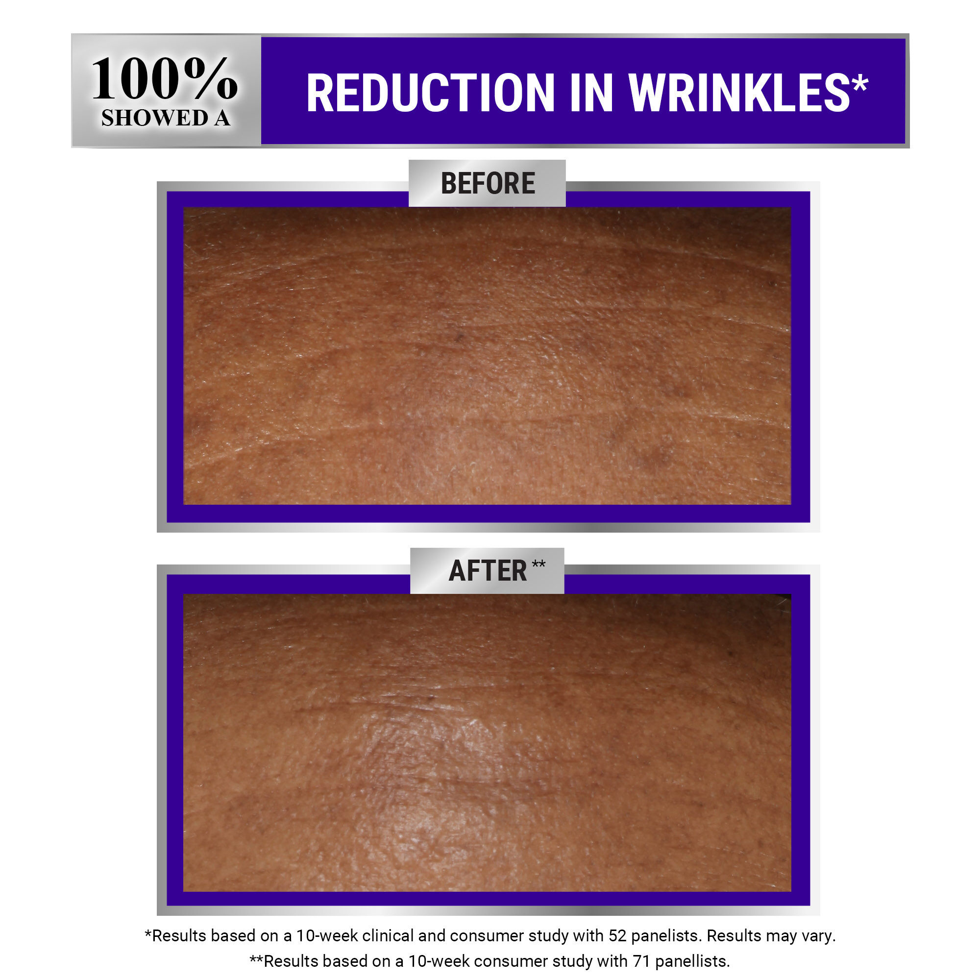 Retinol Fast Release Wrinkle-Reducing Night Serum | Kiehl’s UK