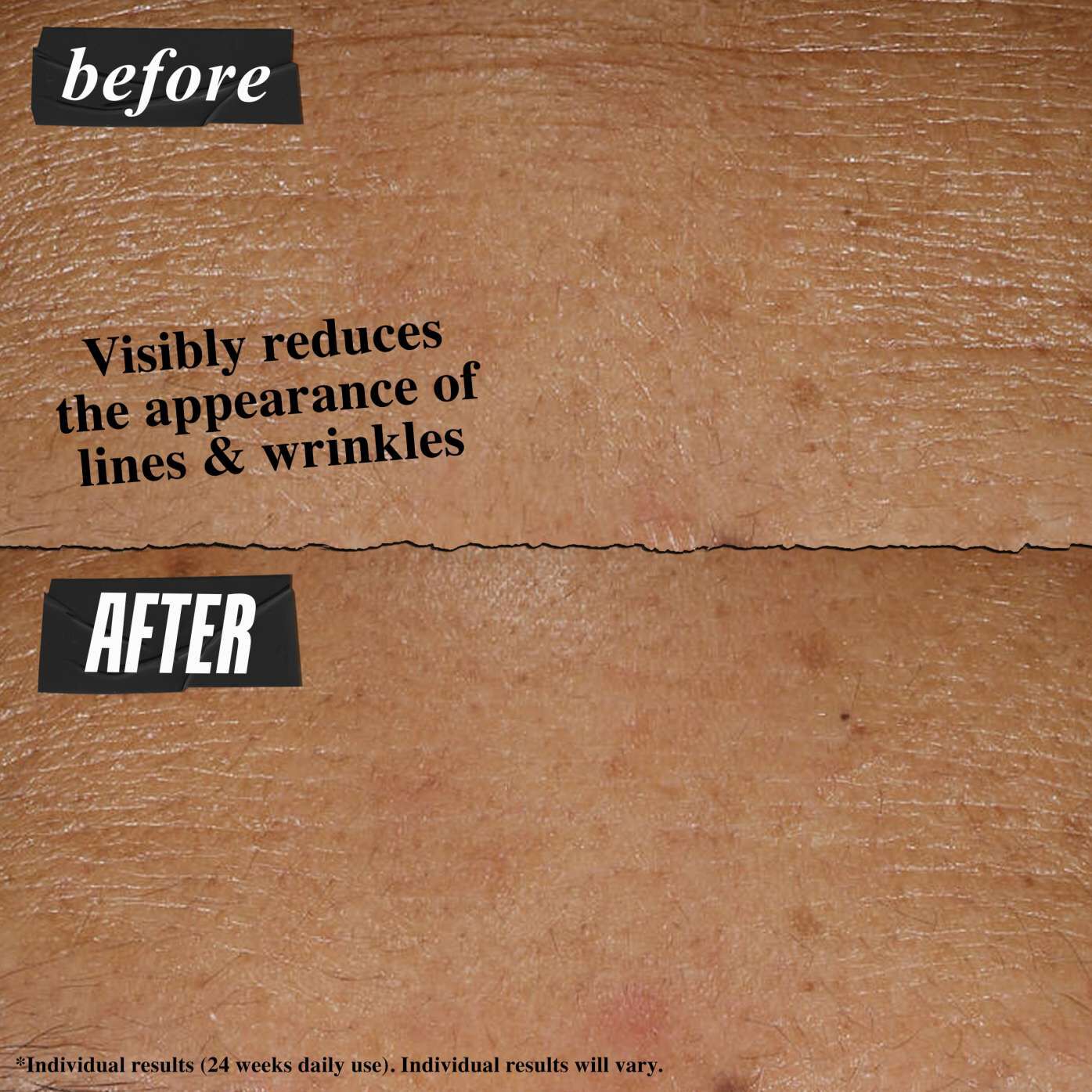 Retinol Serum | Retinol for Face | Anti-Aging | Kiehl's UK